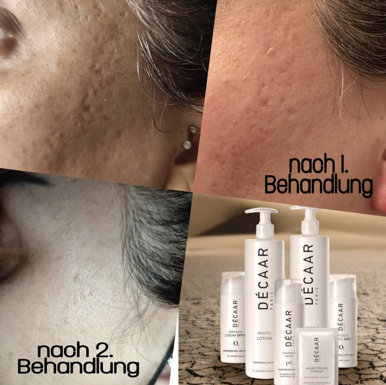 Algenpeeling - beauty-medical-meerbusch.de